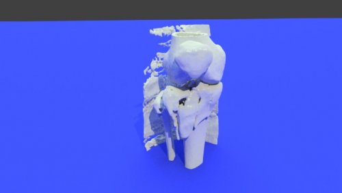 ct knee - stl file processed - Extremity, Lower (Leg) - embodi3D.com