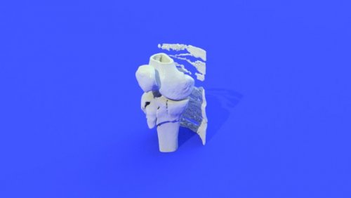 ct knee - stl file processed - Extremity, Lower (Leg) - embodi3D.com