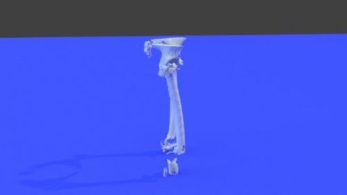 Femur Fracture - stl file processed - Extremity, Lower (Leg) - embodi3D.com