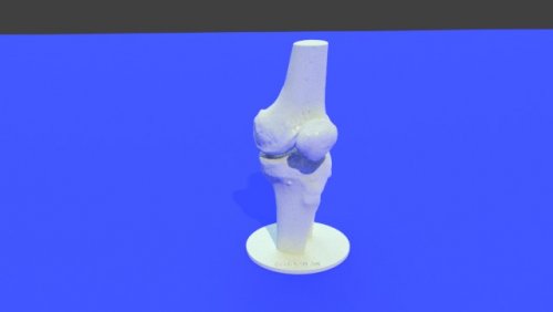 3D Knee - Extremity, Lower (Leg) - embodi3D.com