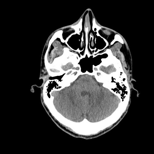 male-model - Skull, Head, and Neck CTs - embodi3D.com