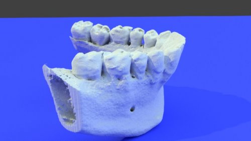 Mandible .stl - Dental, Orthodontic, Maxillofacial - embodi3D.com