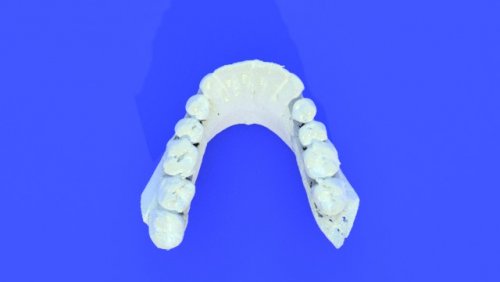 Mandible .stl - Dental, Orthodontic, Maxillofacial - embodi3D.com