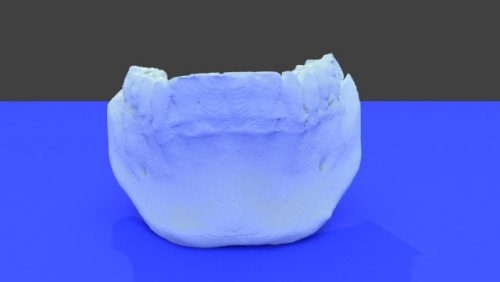 Mandible .stl - Dental, Orthodontic, Maxillofacial - embodi3D.com