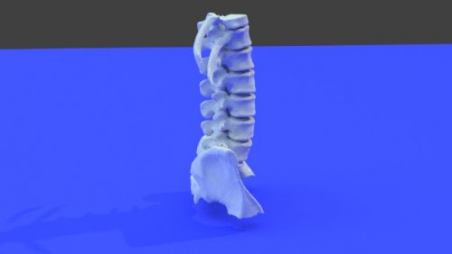 ct lumbar b - stl file processed - Spine and Pelvis - embodi3D.com