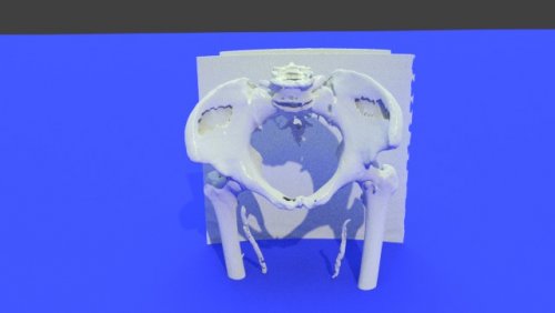 pelvis - stl file processed - Spine and Pelvis - embodi3D.com