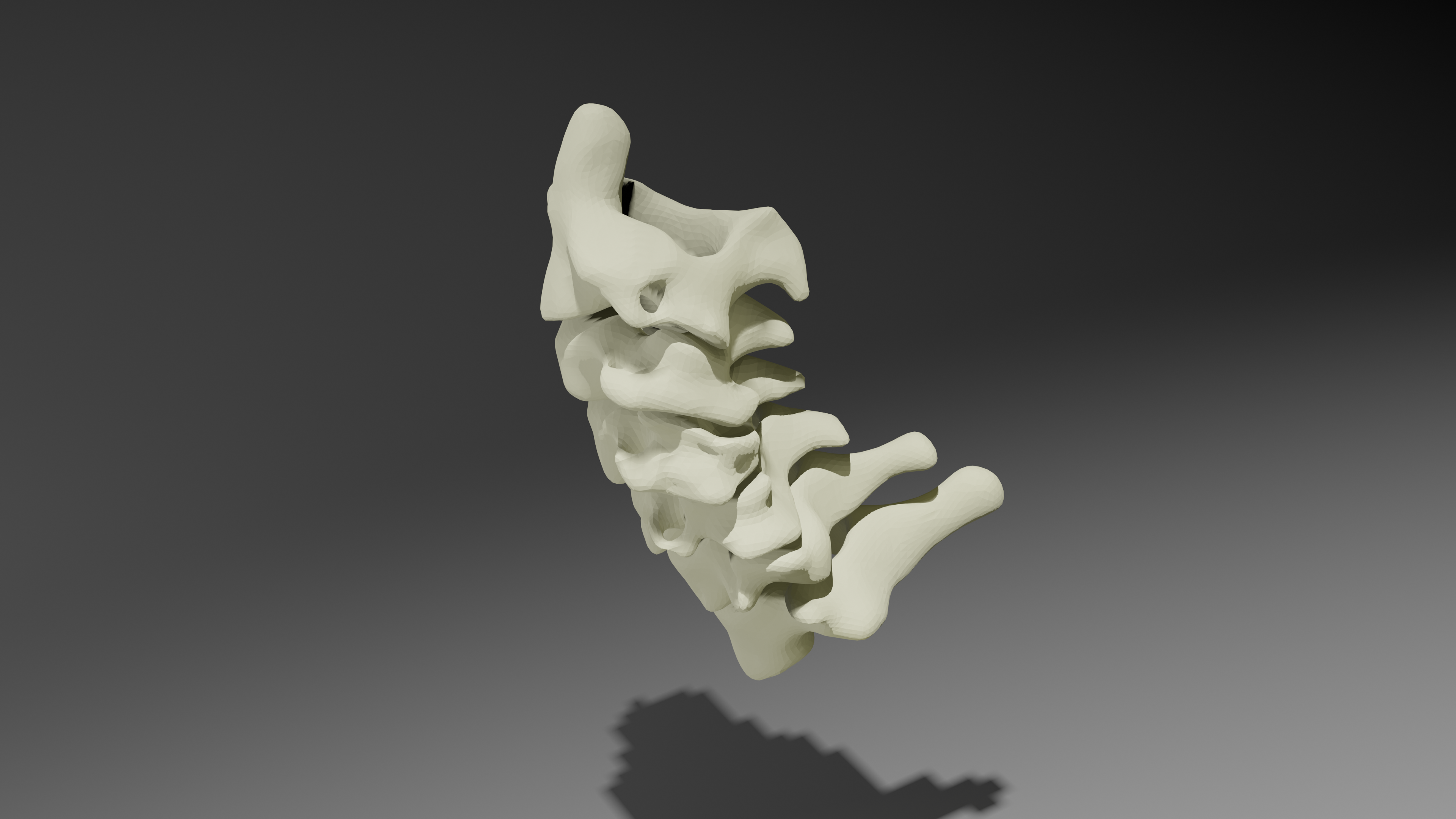 3d Printed Cervical Vertebrae