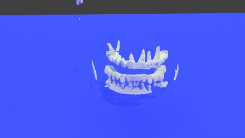 CBCT - stl file processed - Dental, Orthodontic, Maxillofacial ...