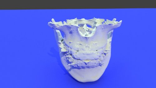 CBCT HB - stl file processed - Dental, Orthodontic, Maxillofacial ...