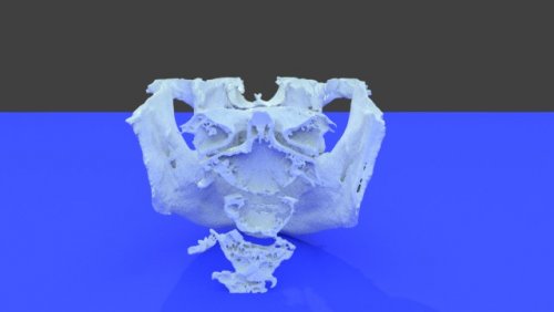 CBCT HB - stl file processed - Dental, Orthodontic, Maxillofacial ...