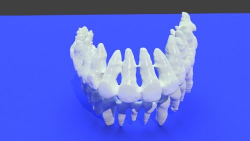 57 - stl file processed - Dental, Orthodontic, Maxillofacial - embodi3D.com