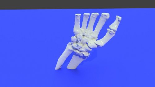 Wrist CT - stl file processed - Extremity, Upper (Arm) - embodi3D.com