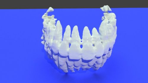 final0057 - stl file processed - Dental, Orthodontic, Maxillofacial ...