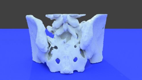 4 LS SAG - imageType DERIVED-PRIMARY-AXIAL-CT_SOM5 MPR - stl file ...