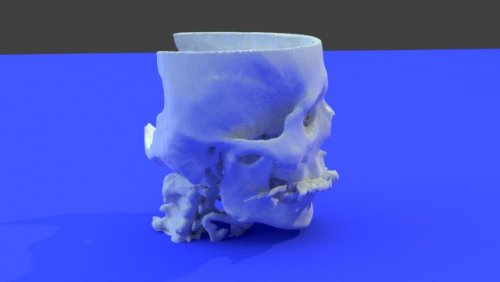 mandible - stl file processed - Dental, Orthodontic, Maxillofacial ...