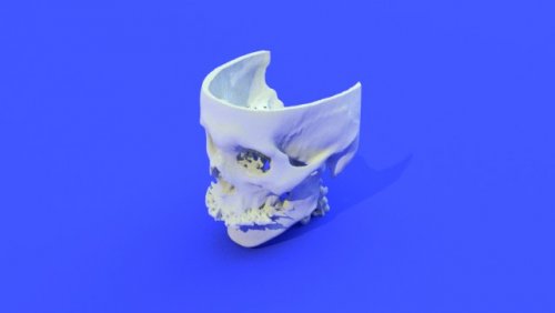 mandible - stl file processed - Dental, Orthodontic, Maxillofacial ...