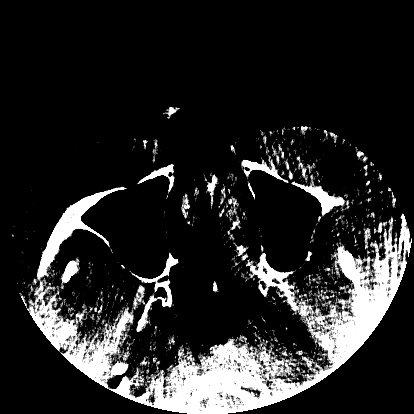 ong stl - Dental, Orthodontic, Maxillofacial CTs - embodi3D.com