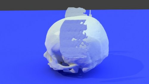 SCAN - stl file processed - Skull and Face - embodi3D.com