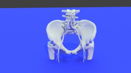 Assignment 5 Gavin Adams - stl file processed - Spine and Pelvis ...