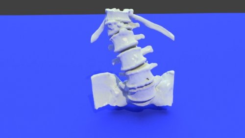 ct l spine pre - stl file processed - democratiz3D® Processing ...