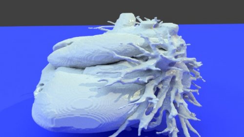 Model of human heart with patent ductus arteriosus (PDA) generated from ...