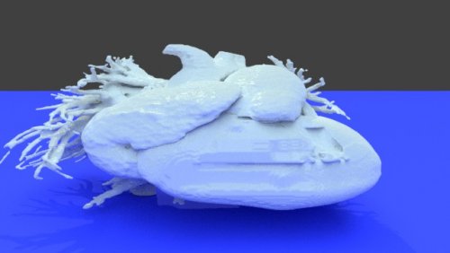 Model of human heart with patent ductus arteriosus (PDA) generated from ...