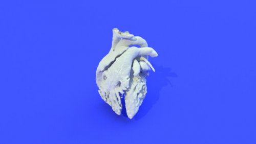 Model of human heart from real patient - Heart - embodi3D.com