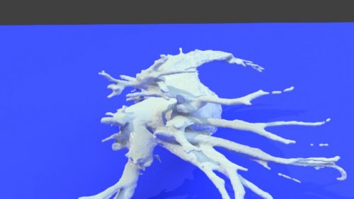 Model of human heart with patent ductus arteriosus (PDA) generated from ...
