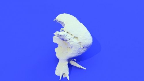 Model of human heart with patent ductus arteriosus (PDA) generated from ...