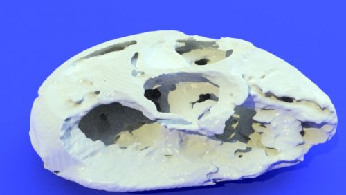 Model of human heart with patent ductus arteriosus (PDA) generated from ...