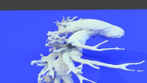 Model of human heart with patent ductus arteriosus (PDA) generated from ...