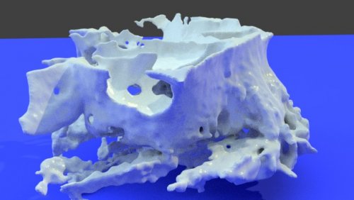 Maxillary CBCT with teeth - stl file processed - Dental, Orthodontic ...