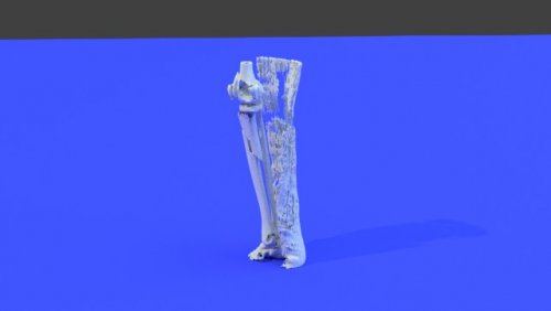 Tibia periprosthetic fracture - stl file processed - Extremity, Lower ...