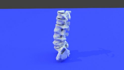 JoeyD Spine 4 - stl file processed - Spine and Pelvis - embodi3D.com