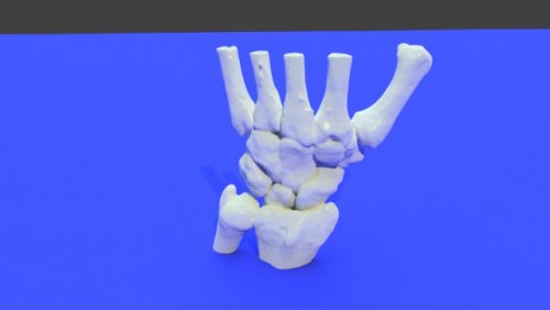 DEMO Wrist CT - stl file processed - democratiz3D® Processing ...