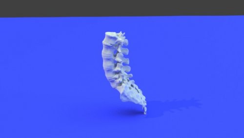 SPINE CT SCAN - stl file processed - Spine and Pelvis - embodi3D.com