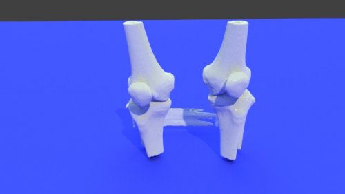 Knee Model - stl file processed - Extremity, Lower (Leg) - embodi3D.com