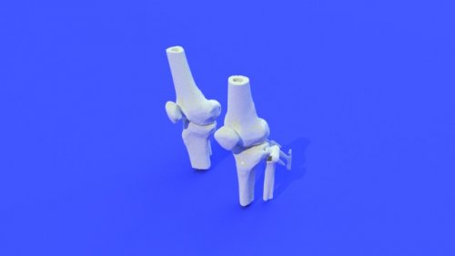 Knee Model - stl file processed - Extremity, Lower (Leg) - embodi3D.com