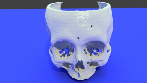 CT scan - stl file processed - Skull and Face - embodi3D.com