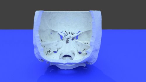CT scan - stl file processed - Skull and Face - embodi3D.com