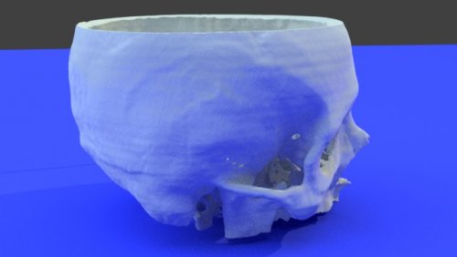 CT scan - stl file processed - Skull and Face - embodi3D.com
