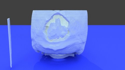 CT scan - stl file processed - Skull and Face - embodi3D.com