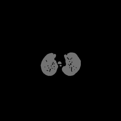 phantom test 3 bone - Thorax CTs - embodi3D.com