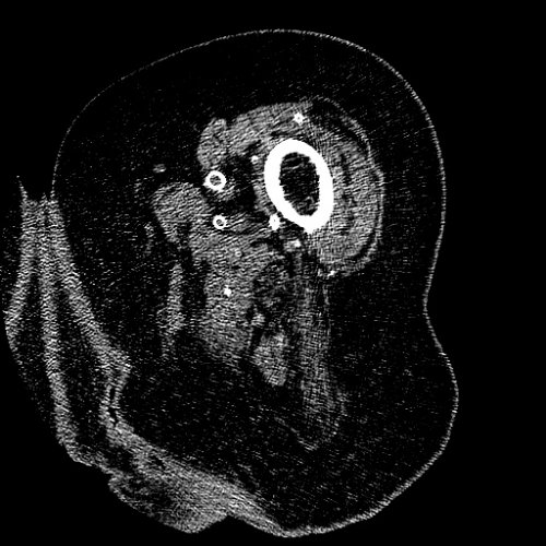 hip pins - democratiz3D® Processing - embodi3D.com