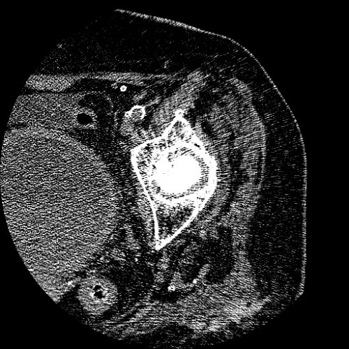 hip pins - democratiz3D® Processing - embodi3D.com