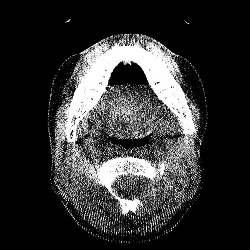 Skull - Skull, Head, and Neck CTs - embodi3D.com