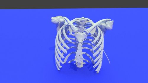 CT chest - stl file processed - Thorax and Ribs - embodi3D.com