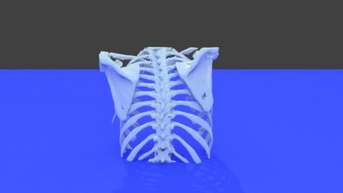CT chest - stl file processed - Thorax and Ribs - embodi3D.com