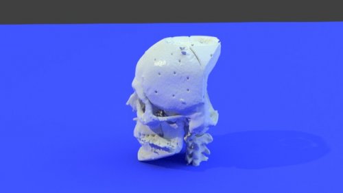 CT-head - stl file processed - Skull and Face - embodi3D.com