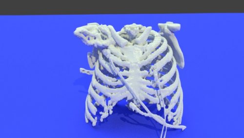 CT scan - stl file processed - democratiz3D® Processing - embodi3D.com